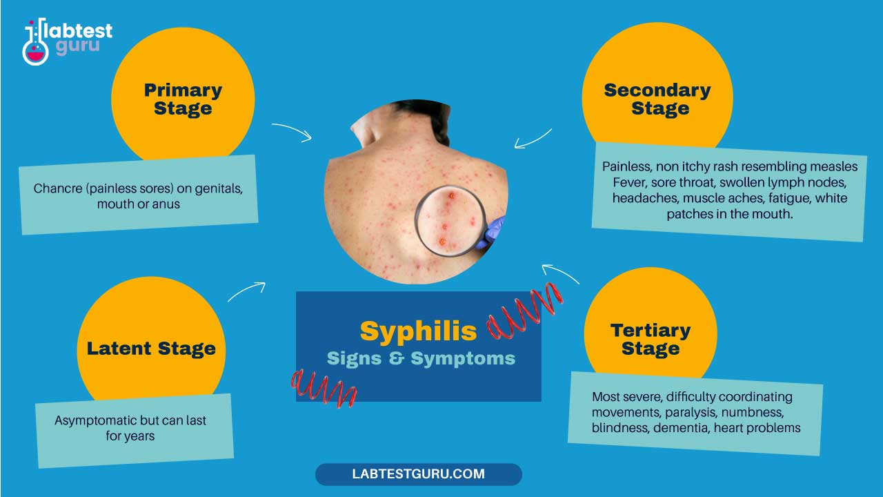 The Ultimate Guide to Syphilis & Tests: All You Need to Know
